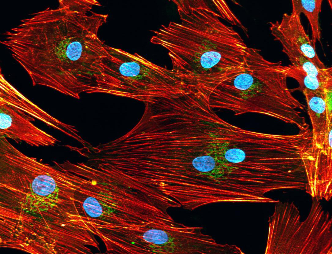 In Vitro Fibrosis Assay Services Phenovista Biosciences